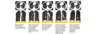 A message from Stryker | Stryker